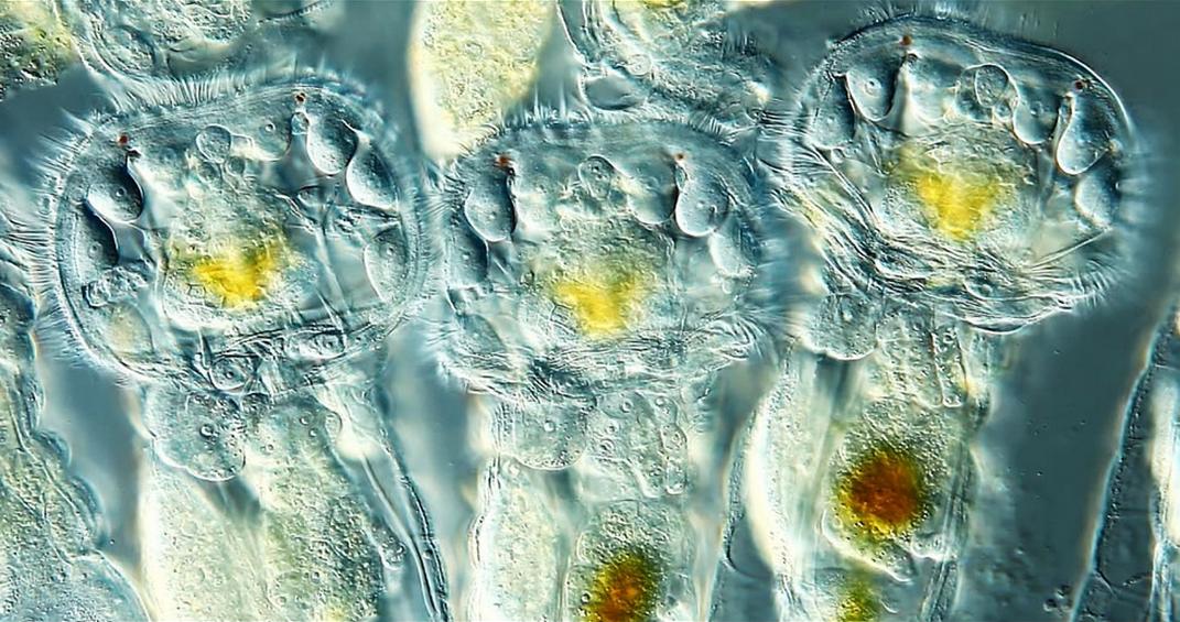 Un Mundo en Paz: Las maravillas del mundo microscópico