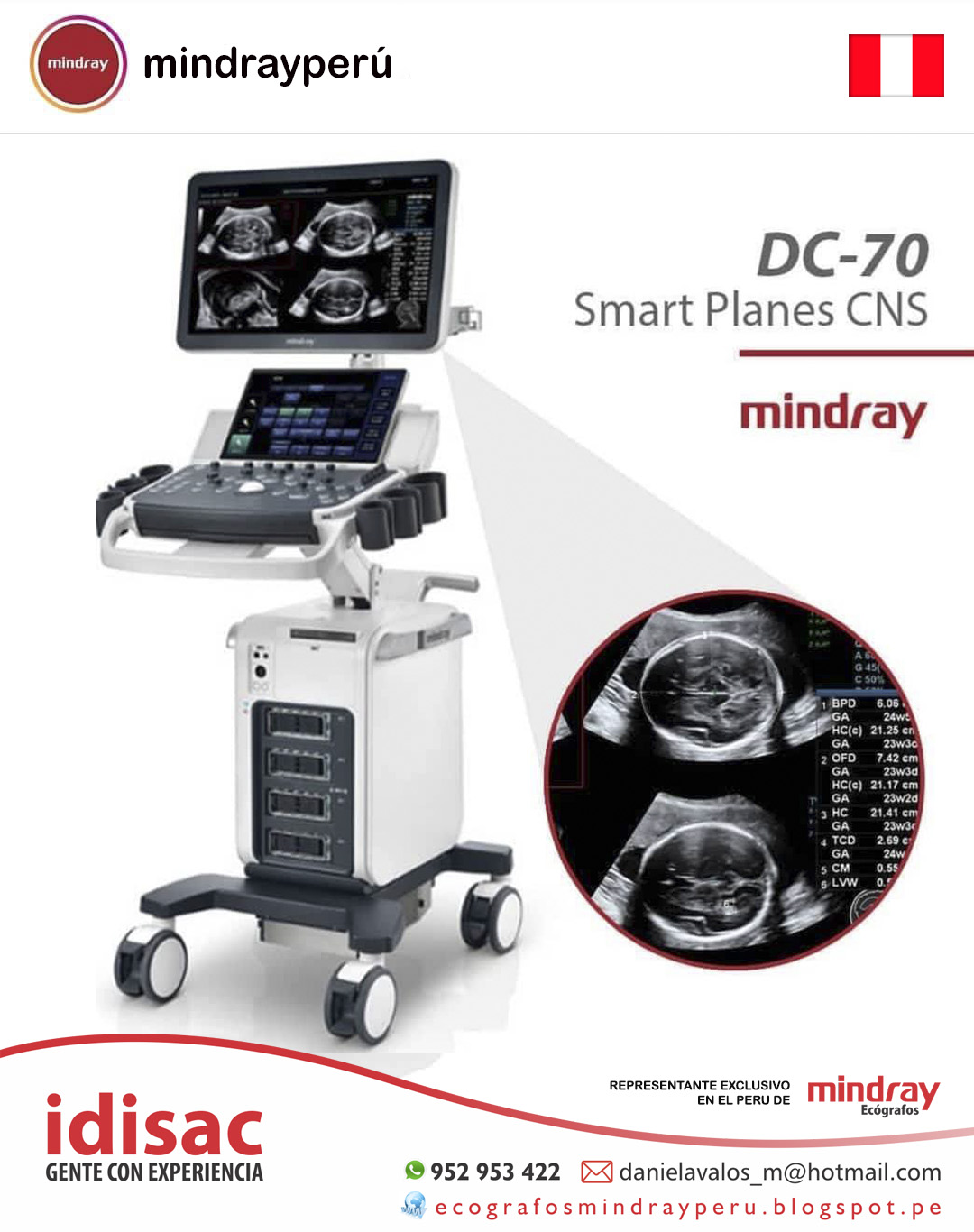 ECOGRAFOS MINDRAY PERU - Venta de Equipos Medicos - IDISAC idisac ...