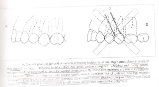 WizDent: Principles Of Complicated Exodontia-Surgical/Open method of ...