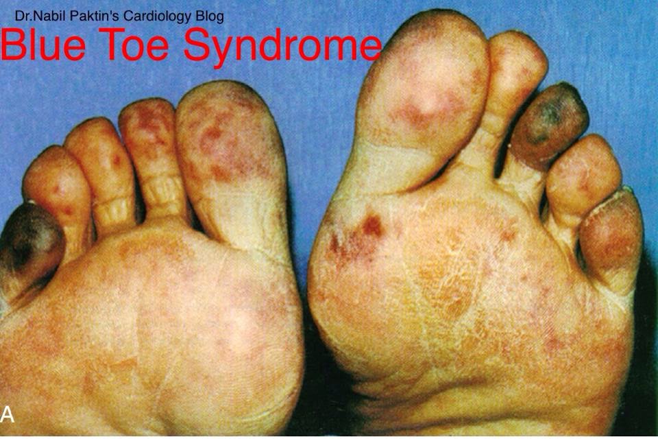 Dr.Nabil Paktin's Cardiology Blog مجله کاردیولوژی دکتور نبــیل پاکطـین ...