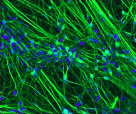 progeria family circle: Unique molecular mechanism protects neurons in ...