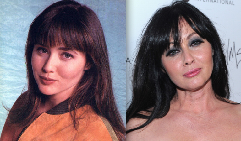 Shannen Doherty Plastic Surgery