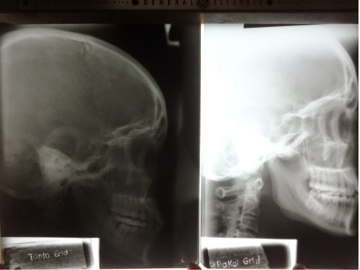 PUSAT KAJIAN RADIOGRAFI DAN IMAJING