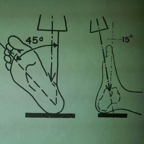 Proyecciones de tobillo. Isherwood, Broden I y Broden II, Aprende Fitness