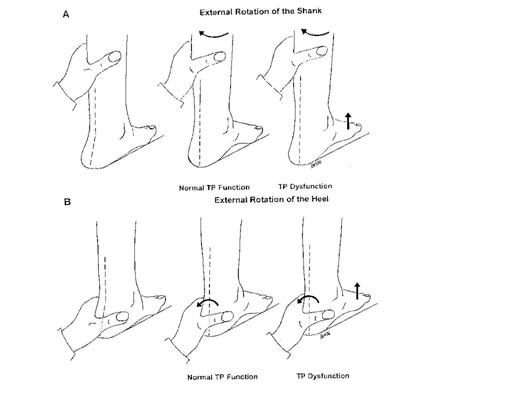 Ortopodologia y Biomecanica : TEST DEL PRIMER METATARSIANO PARA ...