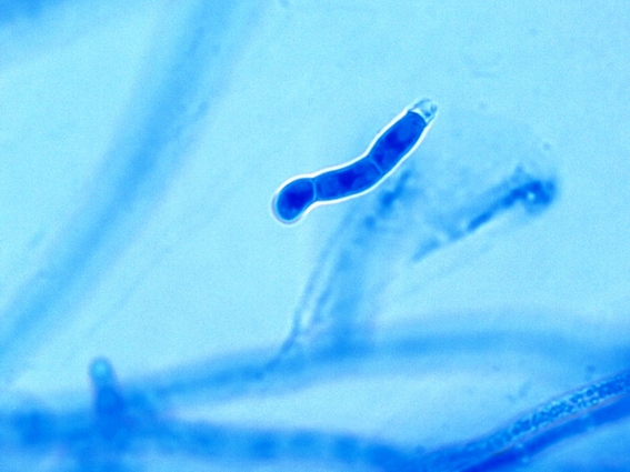 Fun With Microbiology (What's Buggin' You?): Trichophyton tonsurans