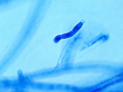 Fun With Microbiology (What's Buggin' You?): Trichophyton tonsurans