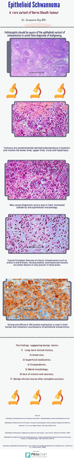 Pathology Infographics : Epithelioid Schwannoma - A rare variant of ...
