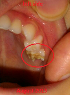 Faith, Family & Fitness: The story behind our INSANELY strict diet and ...