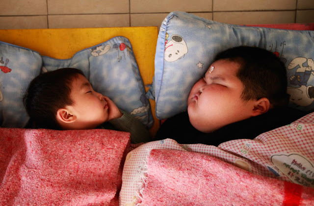 Anecdote World: 4-year-old super-fat baby, weighing over 120 pounds