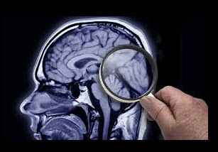 What is the Amnesia Disease?