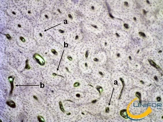 Atlas Histológico UNIFOR-MG: Osso compacto