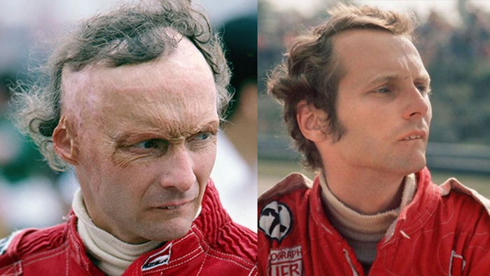El famoso accidente de Niki Lauda que lo hizo una leyenda - humbertothen®