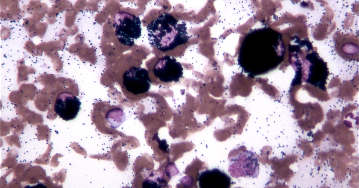 Veterinary Clinical Pathology: Cytology: Canine subcutaneous mass FNA