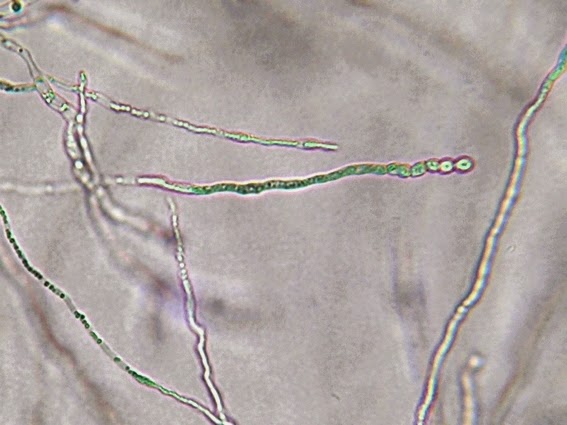 Fun With Microbiology (What's Buggin' You?): Trichosporon species