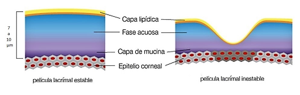 OJO SECO GRAVE Y SJÖGREN: FUNCIÓN DE LAS CAPAS DE LA LÁGRIMA