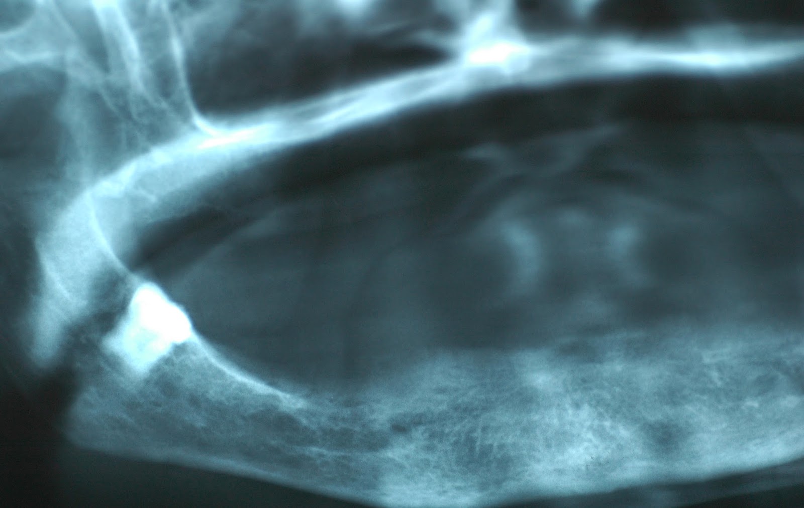 Grupo de estudios odontológicos de Cuenca: Cordales