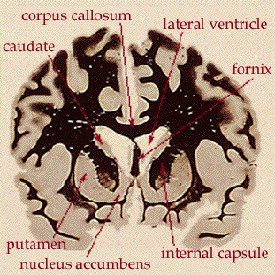 Neuroanatomy Tutorial: 1. Coronal and Horizontal Sections