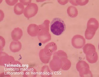 Fichero de hematología. Células sanguíneas.: Serie linfocítica