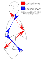 Anatomy of the Sinew Channels: Acupuncture Treatment for the Spiral Line