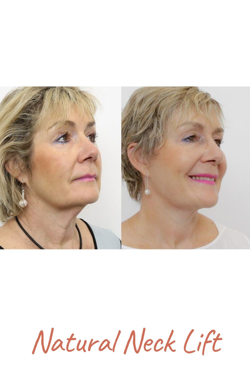 Natural Neck Lift - Pukrol Satwa