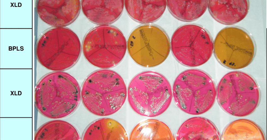 Coprocultura:o básico que precisamos saber. - Análises Clínicas.com