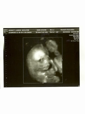 A Day in the Life of the Howlett Family: 20 Week Ultrasound