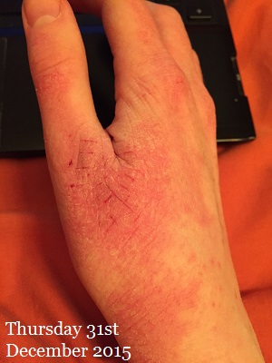 Hand-some | TSW Cara