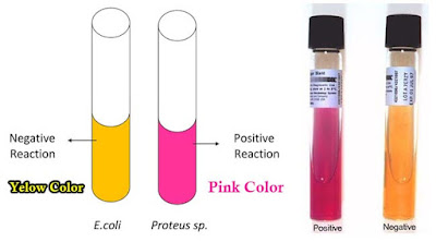 ÜRE TESTİ (UREASE TEST) - Microbiology Lab Notes