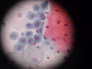 Atlas de Citologia Clínica - Profa Dra Lucila Ludmila Paula Gutierrez ...