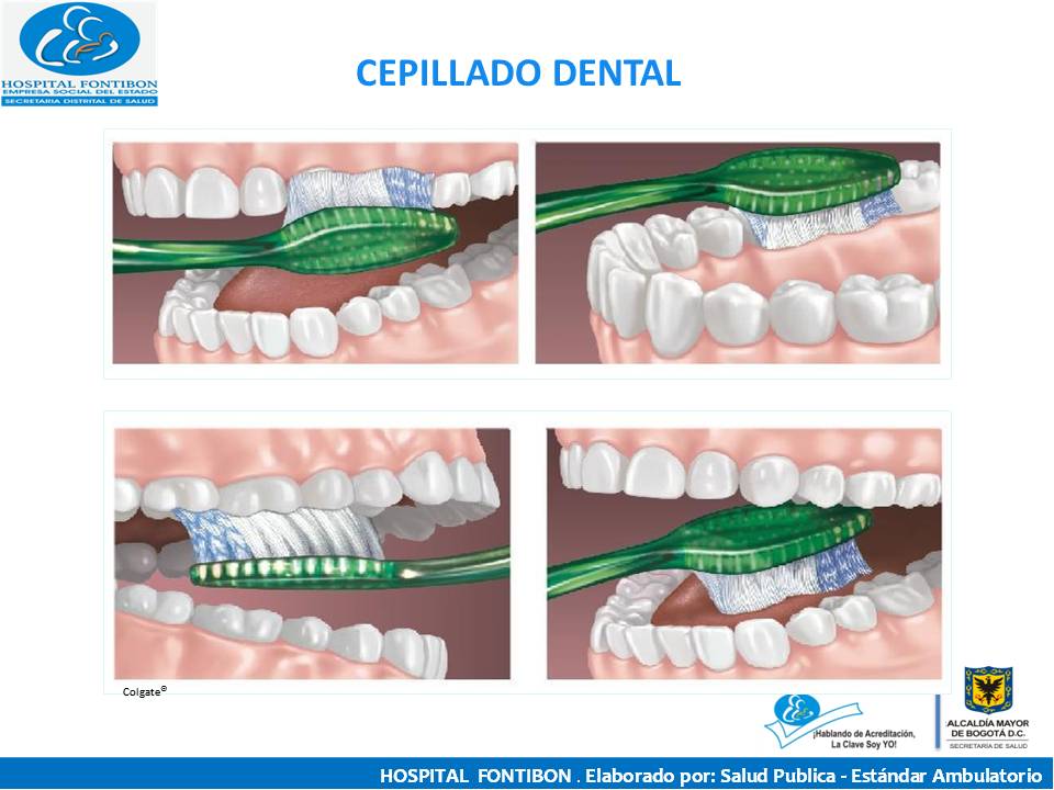 Ambito IPS: ROTAFOLIO DE SALUD ORAL