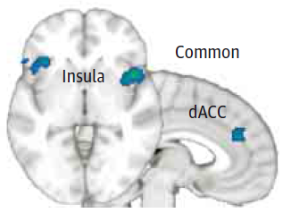The Neurocritic: One Brain Network for All Mental Illness