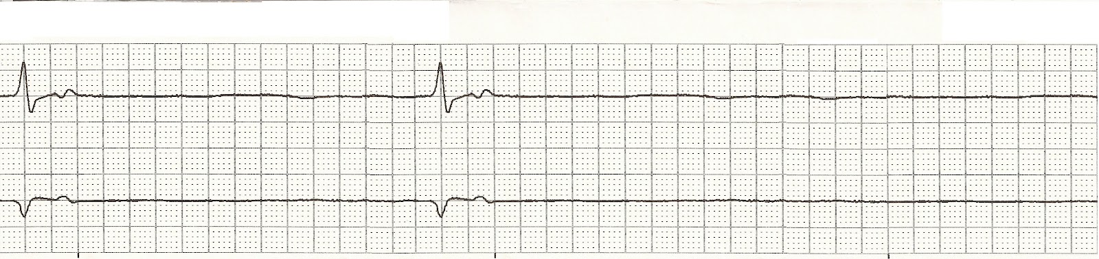 For in that sleep of death what dreams may come...