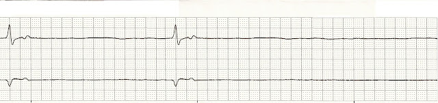 For in that sleep of death what dreams may come...