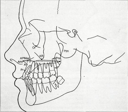 Dentistry lectures for MFDS/MJDF/NBDE/ORE: Note on Radiographic Anatomy ...
