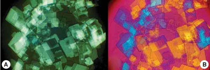 [Haematology] Atlas of Serous Body Fluids | Free Medical Atlas