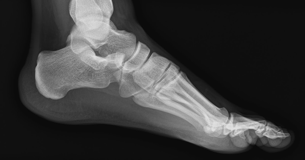 CURSO ANATOMÍA ULA: Radiografías de pie