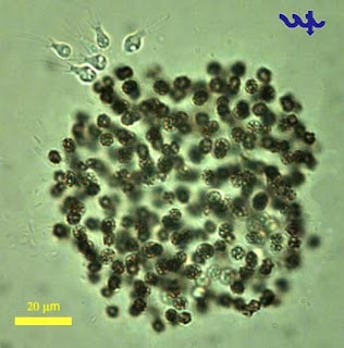 Microcystis