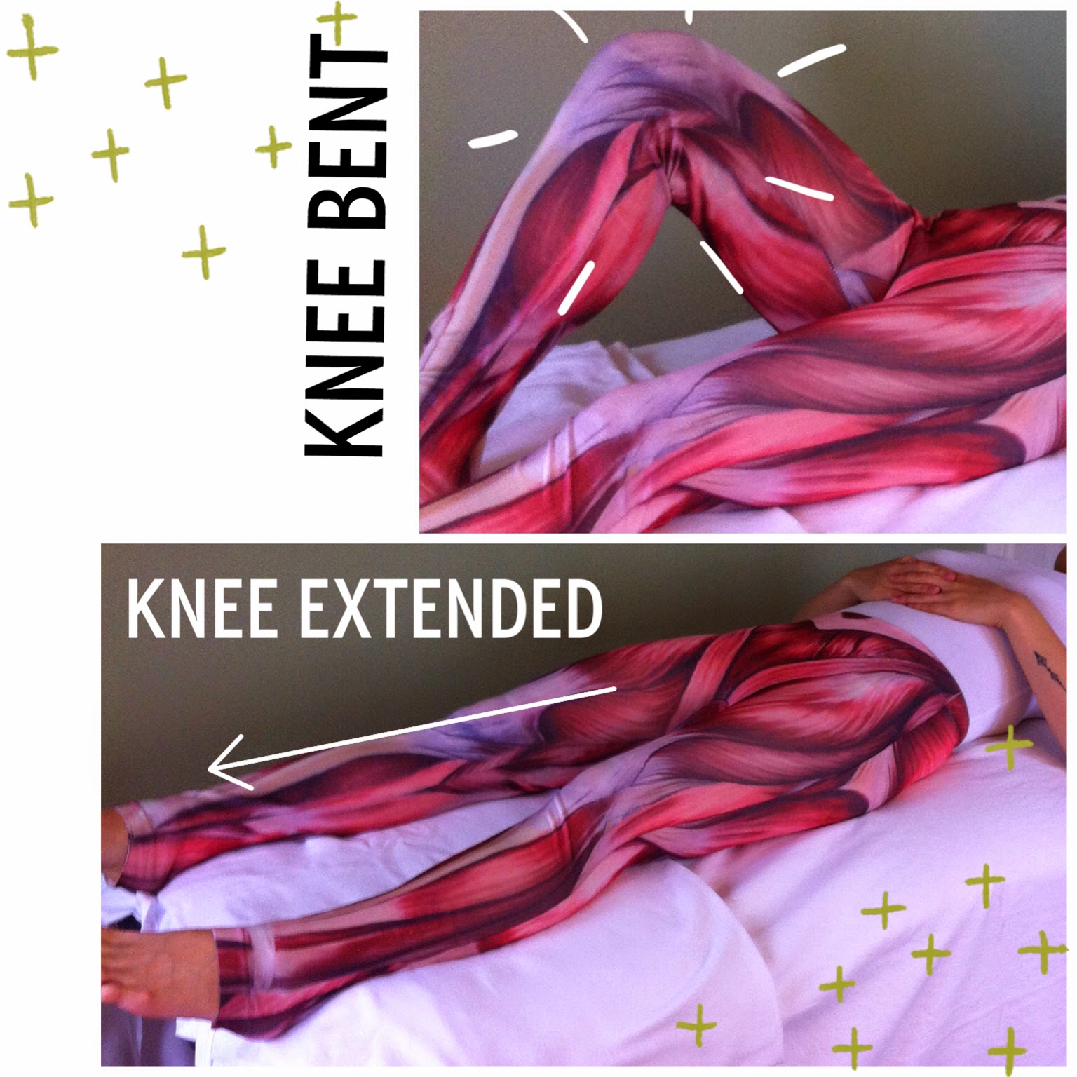 The Hip Joint: Rectus Femoris - 1 of 4 Quads