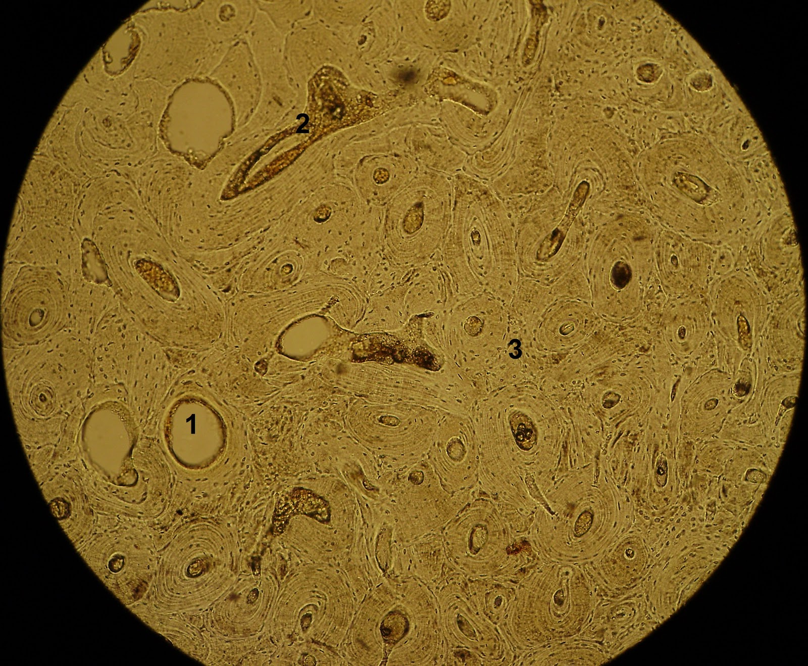 Histologia UFJF: Tecido Ósseo - Osso Compacto
