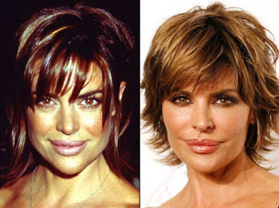 Information Hub: Celebrities before and after Plastic Surgery
