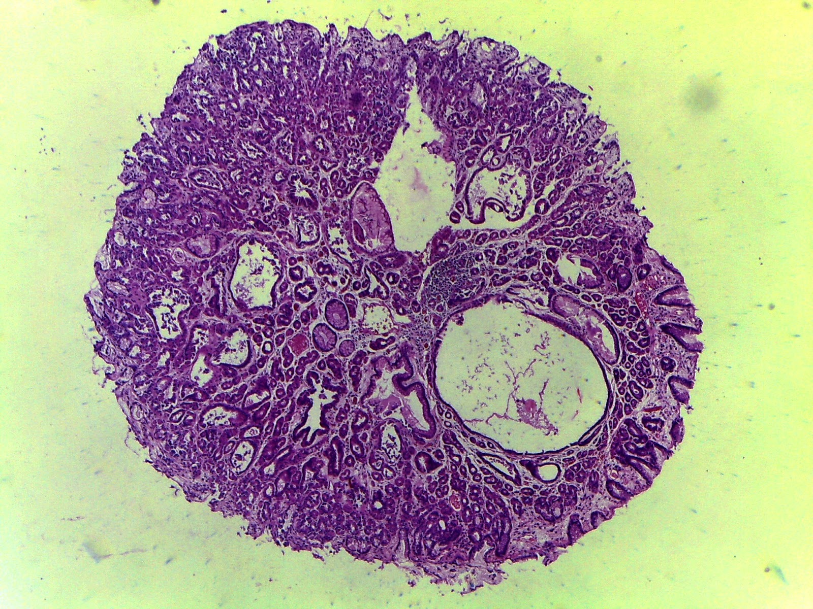 GASTROINTESTINAL AND LIVER HISTOLOGY PATHOLOGY ATLAS: STOMACH: FUNDIC ...