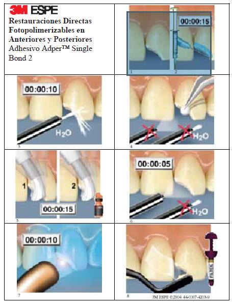 Perfiles de los materiales de la Clínica II: Adper™ Single Bond 2