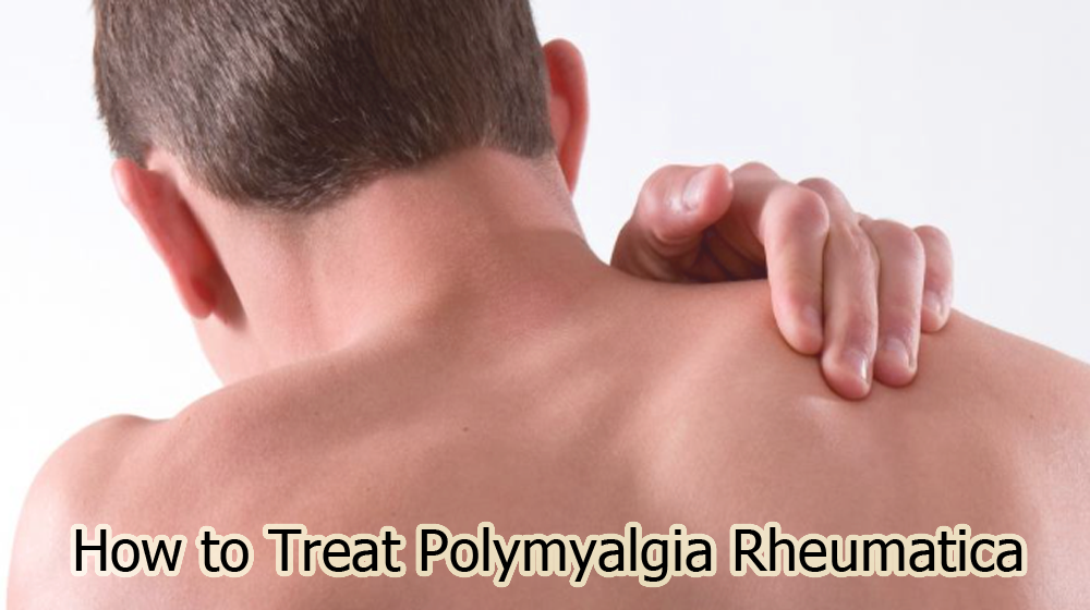 How to Treat Polymyalgia Rheumatica