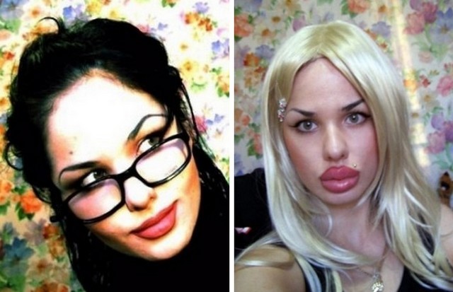 Kristina Rei Plastic Surgery Disaster