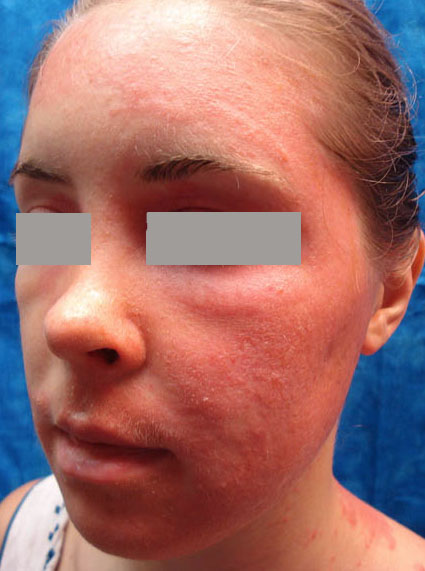 VIRTUAL GRAND ROUNDS IN DERMATOLOGY 2.0: Deadline Looming