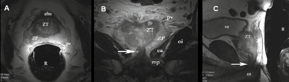 L’imagerie (2. Explorations en coupes)