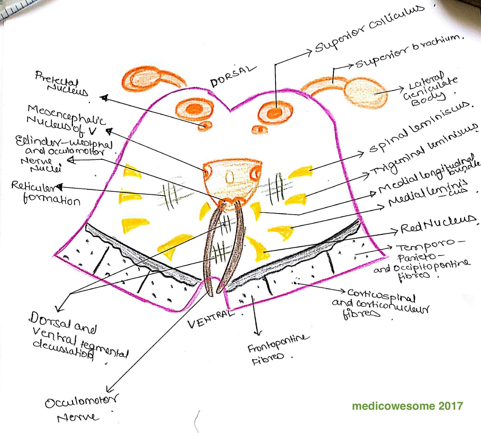 Medicowesome: How to draw midbrain sections and lesions (Fun mnemonic ...