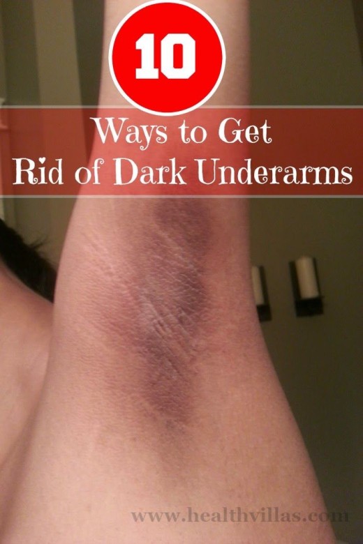 Brilliant Ways To Get Rid Of Dark Underarms Health Fitness Beauty brilliant-ways-to-get-rid-of-dark-underarms-health-fitness-beauty