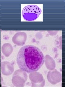 fichero de Hematologia